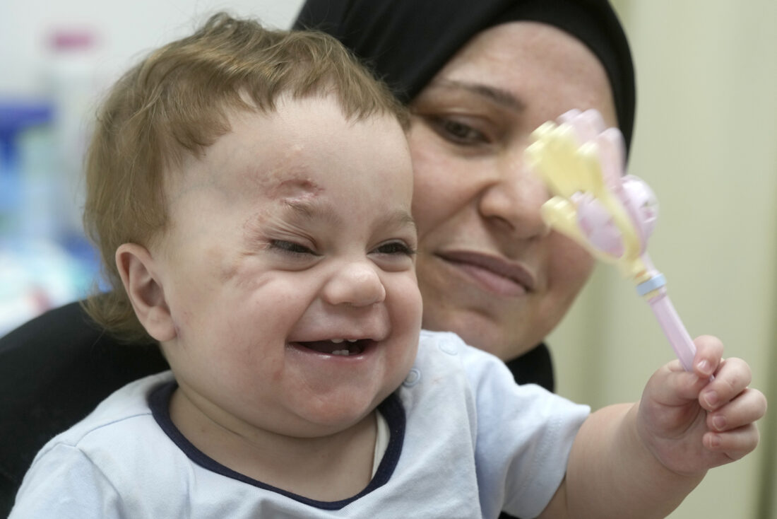 A baby evacuated from Gaza lost an eye and most of his family in the ...